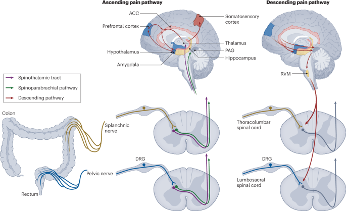 Mechanisms of chronic abdominal pain in inflammatory bowel disease and ...