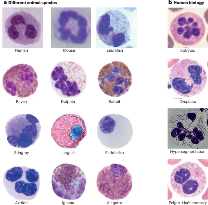 Shaping neutrophil morphology and function: the importance of a ...