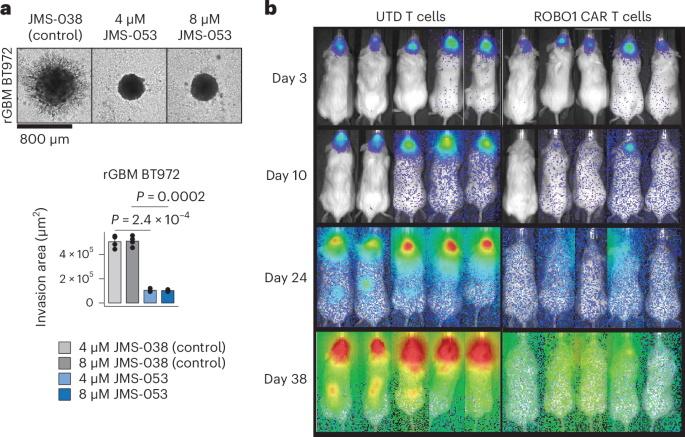 Discovering and targeting vulnerabilities in invasive brain cancer ...