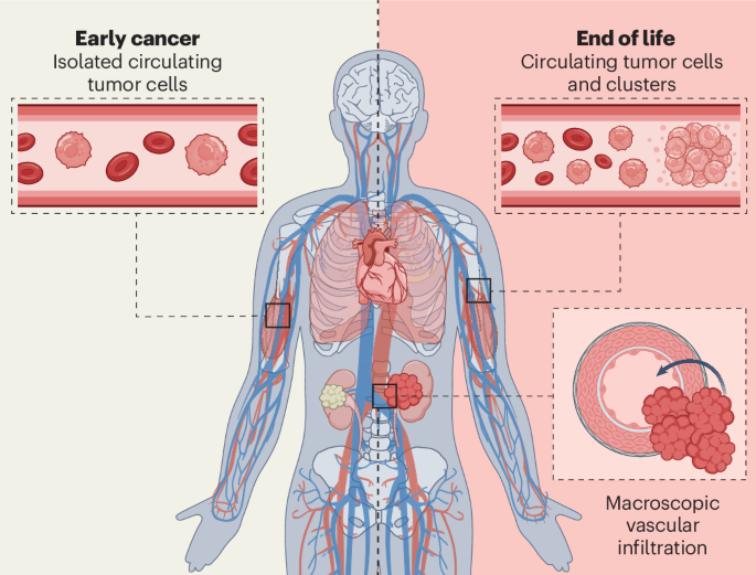 Understanding end-of-life cancer biology | Nature Medicine