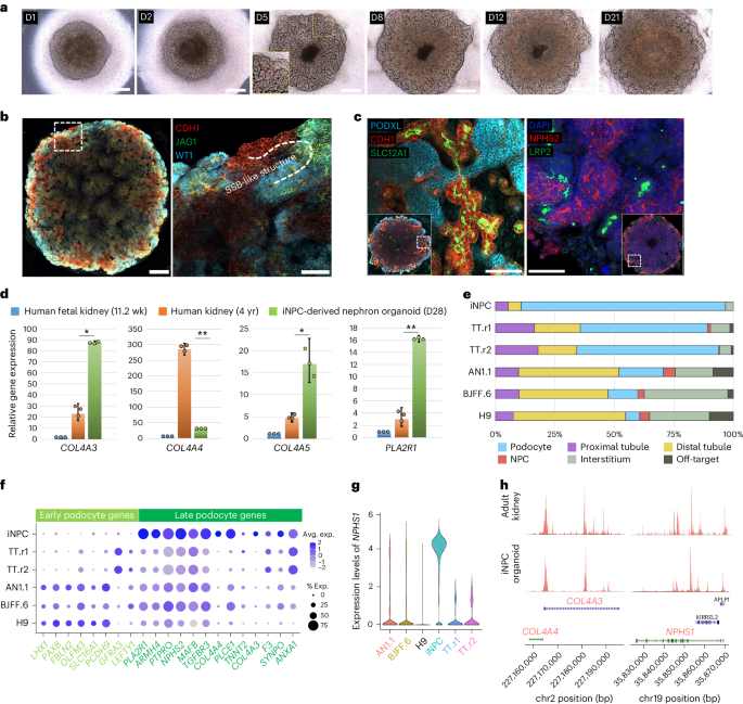 Expansion of human pluripotent stem cell–induced nephron progenitor ...