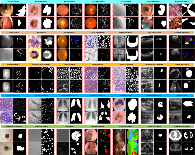 MedSegBench: A comprehensive benchmark for medical image segmentation ...
