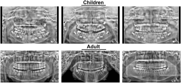 A multi-modal dental dataset for semi-supervised deep learning image ...