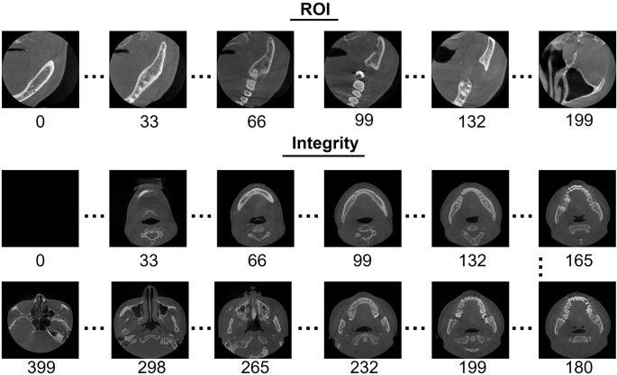 A multi-modal dental dataset for semi-supervised deep learning image ...