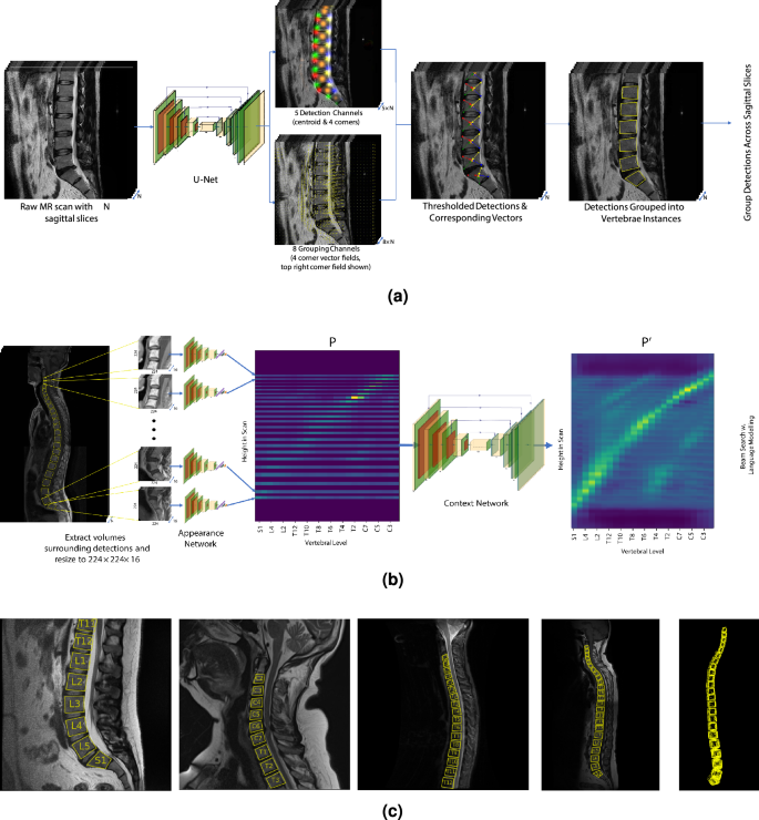 Automated detection, labelling and radiological grading of clinical ...