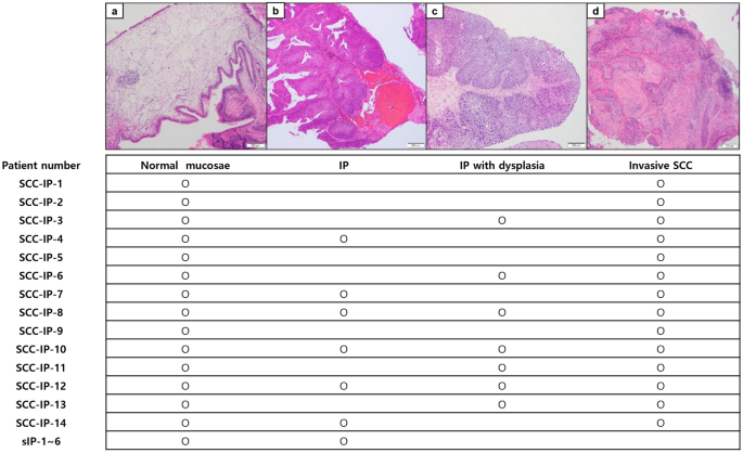 Assessment of TP53 and CDKN2A status as predictive markers of malignant ...
