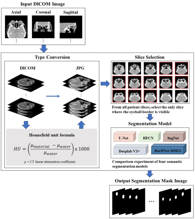 Automated eyeball volume measurement based on CT images using neural ...