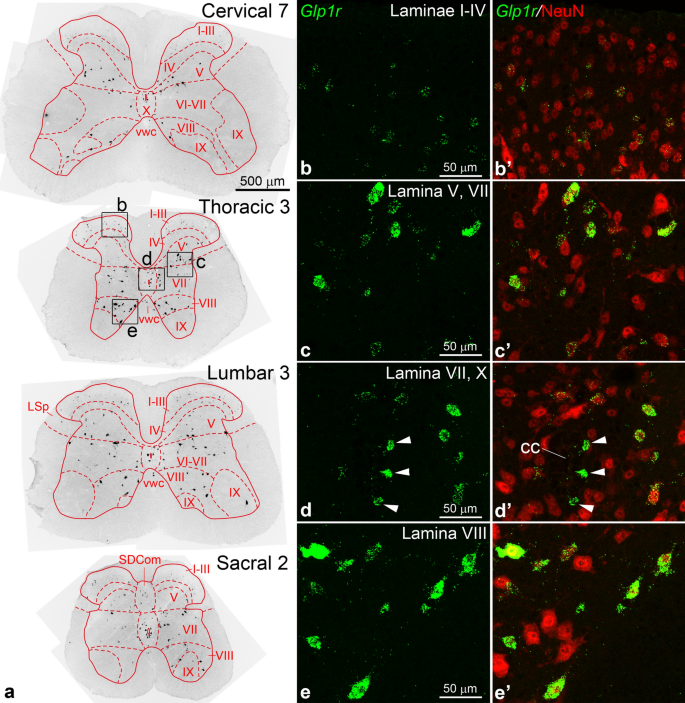 Topography of the GLP-1/GLP-1 receptor system in the spinal cord of ...