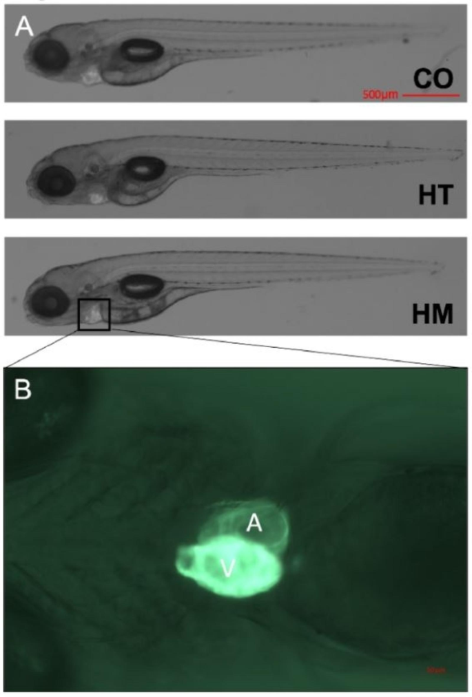 Deciphering metabolomics and lipidomics landscape in zebrafish ...