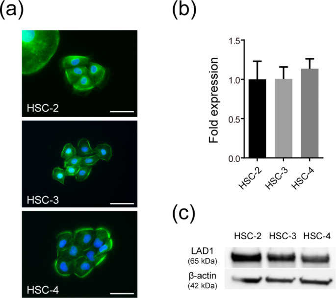 Ladinin-1 in actin arcs of oral squamous cell carcinoma is involved in ...