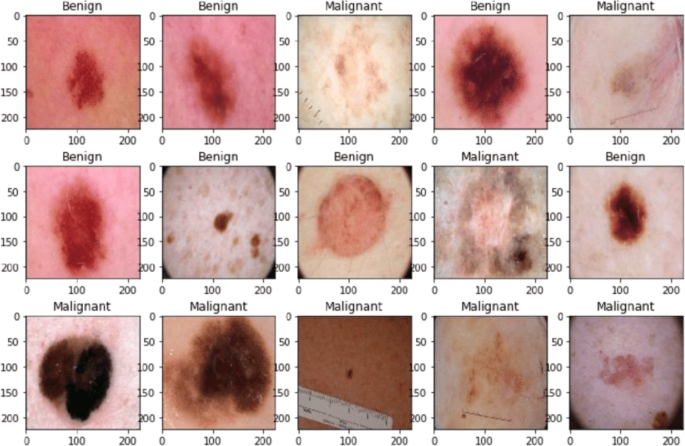 Classification of melanoma skin Cancer based on Image Data Set using ...