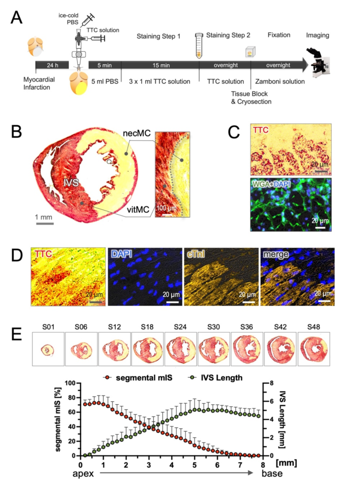 A refined TTC assay precisely detects cardiac injury and cellular ...
