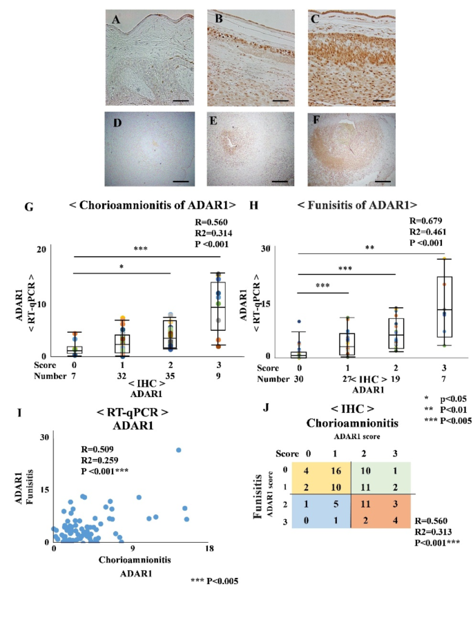 ADAR1 could be a potential diagnostic target for intrauterine infection ...