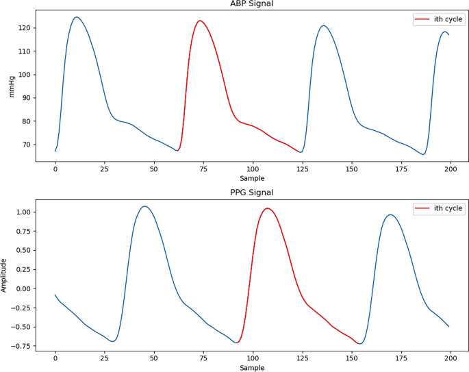 Robust modelling of arterial blood pressure reconstruction from ...
