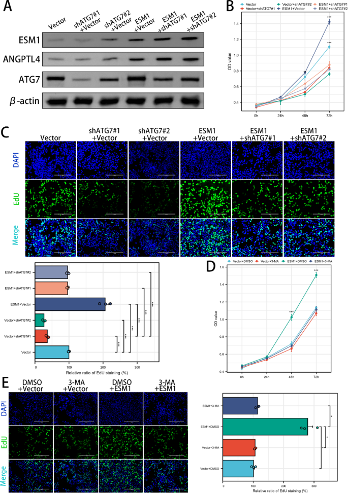Unveiling the protective role of ESM1 in endothelial cell proliferation ...