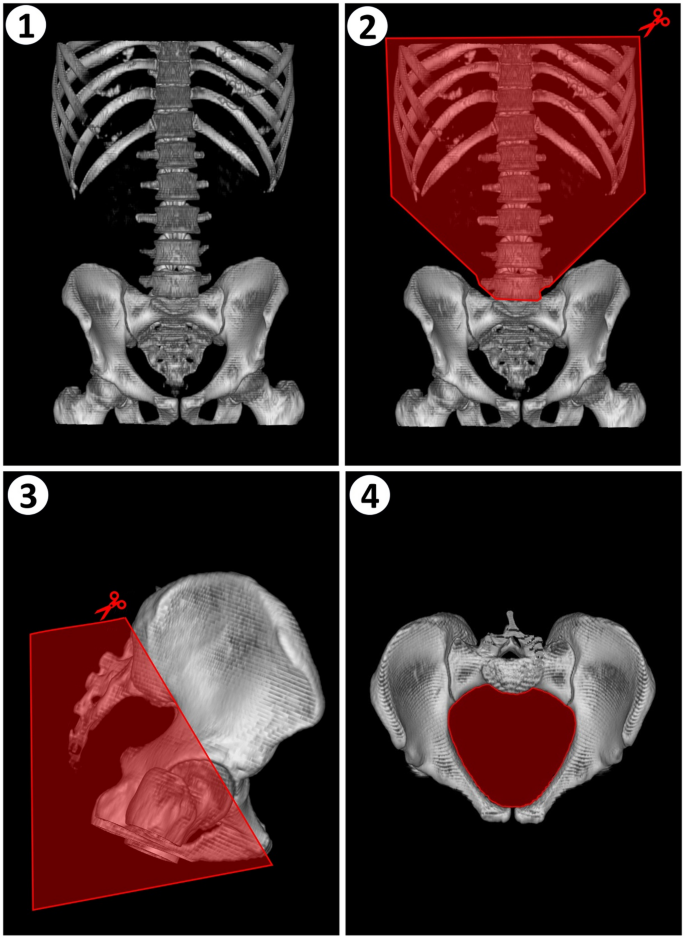 Sex determination using image processing reveals elliptical features of ...