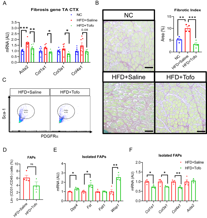 Tofogliflozin ameliorates cardiotoxin induced skeletal muscle injury ...