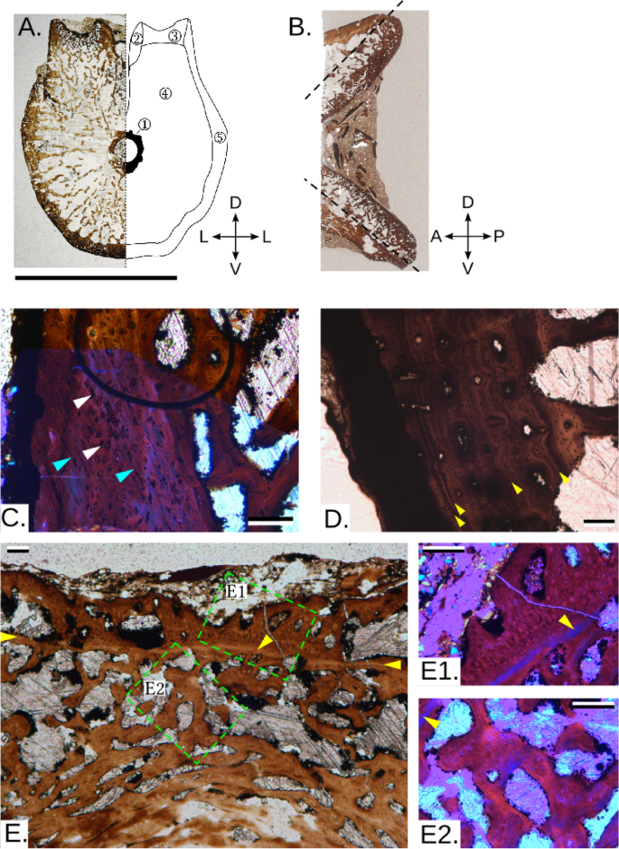 Vertebral microstructure marks the emergence of pelagic ichthyosaurs ...