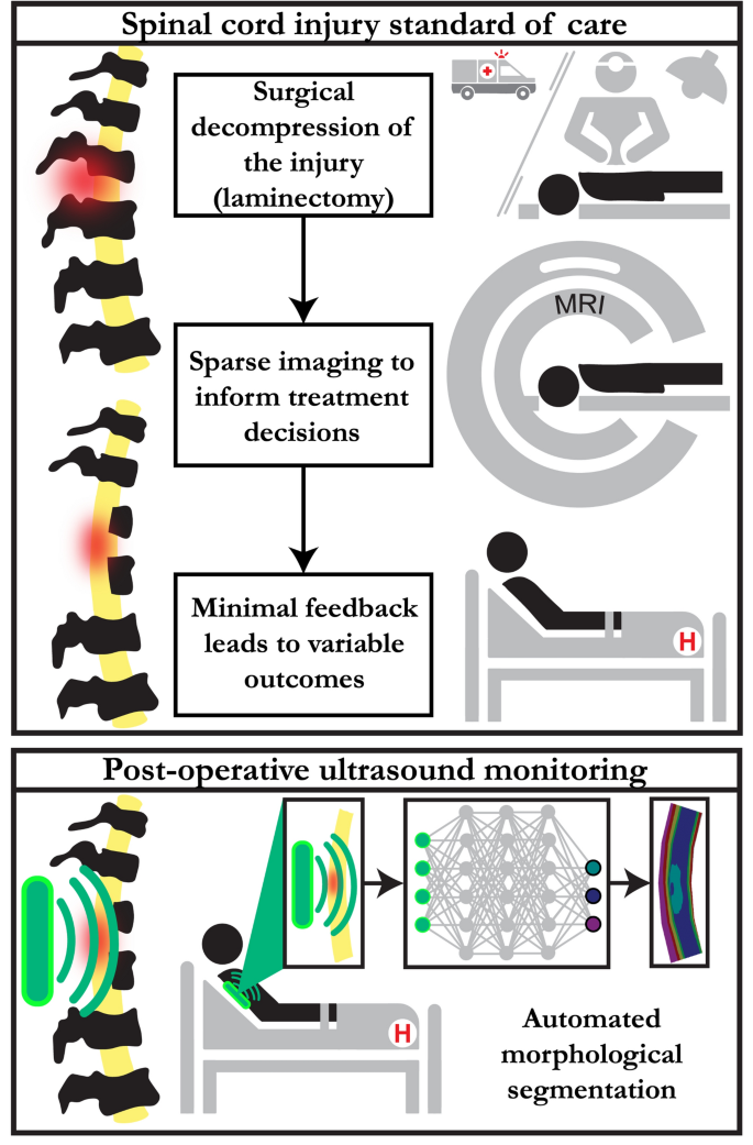 A novel open-source ultrasound dataset with deep learning benchmarks for spinal cord injury ...