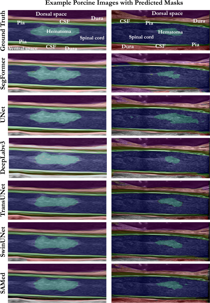 A novel open-source ultrasound dataset with deep learning benchmarks ...