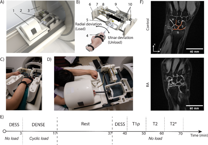 Displacement-encoded MRI reveals biomechanical stiffening in rheumatoid ...