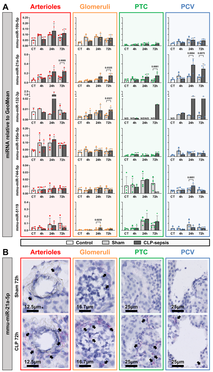 Sepsis-associated acute kidney injury in mice and humans elicits ...