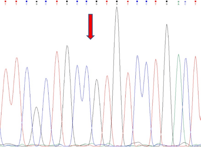 Unraveling the link between GNAS R201 mutation and colorectal cancer ...