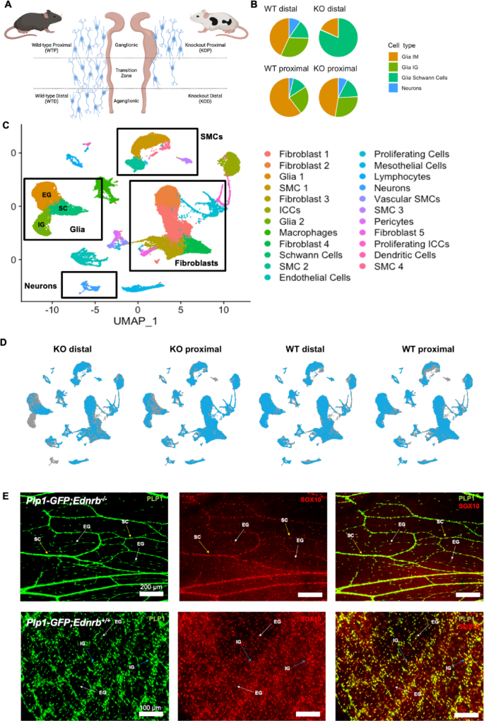 Intramuscular enteric glia persist in Hirschsprung disease and undergo ...