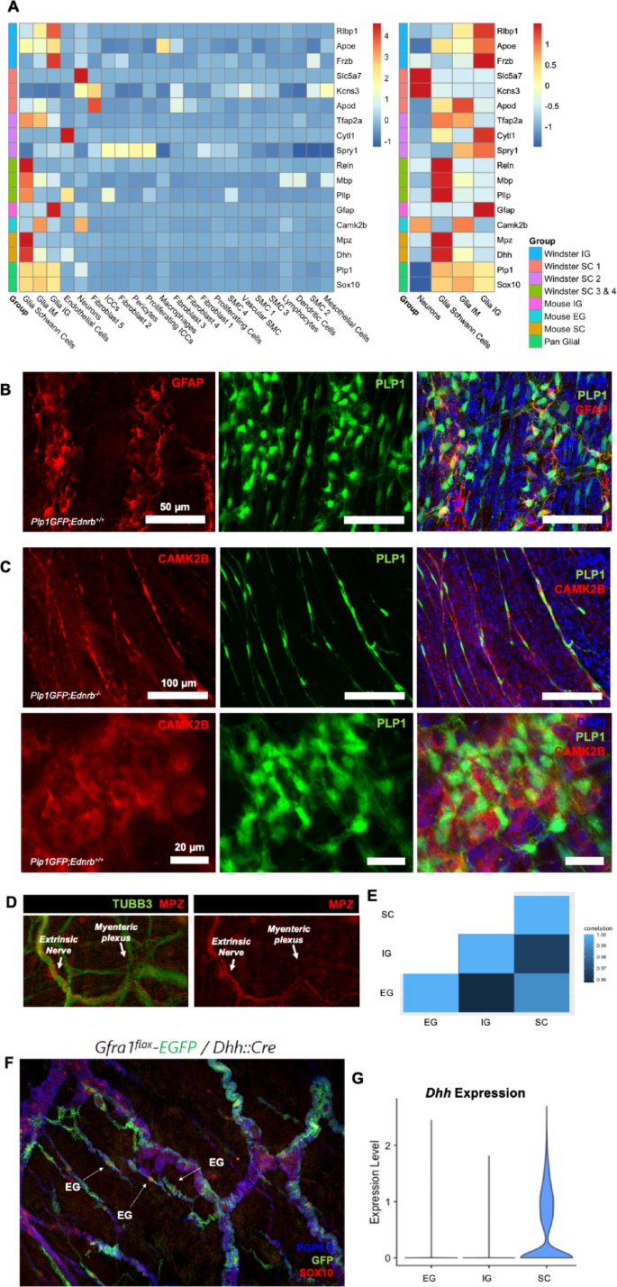 Intramuscular enteric glia persist in Hirschsprung disease and undergo ...