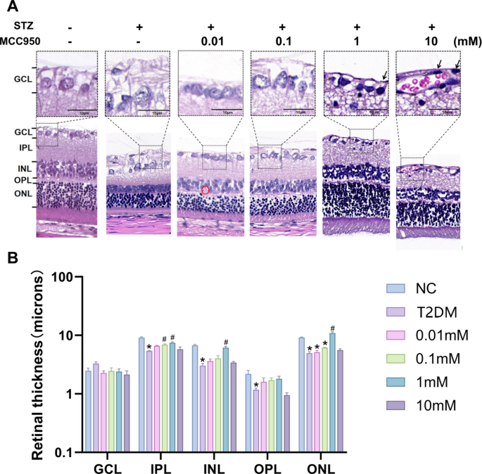 MCC950 targets the ROS-NEK7-NLRP3 axis to improve type 2 diabetic ...