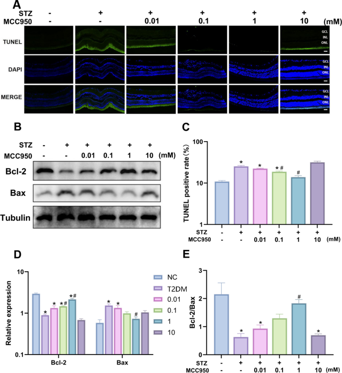 MCC950 targets the ROS-NEK7-NLRP3 axis to improve type 2 diabetic ...