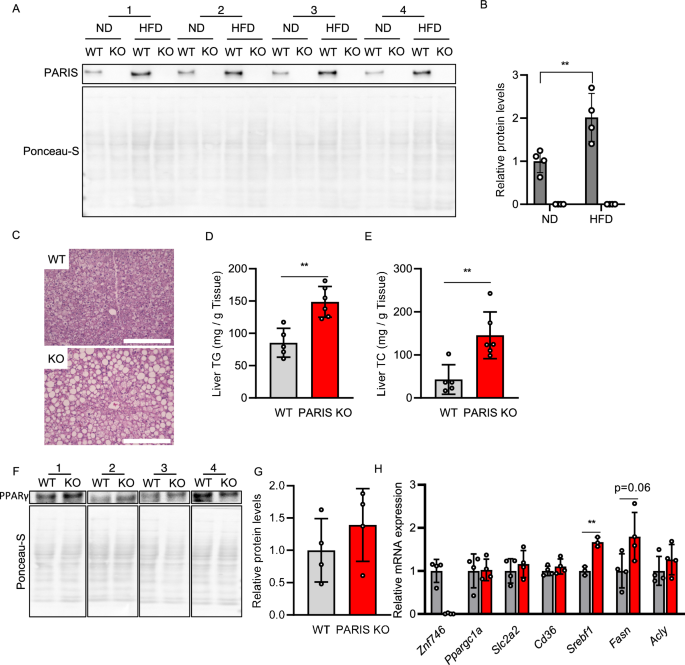 PARIS/ZNF746 DNA-binding domain deficiency promotes adipose tissue ...