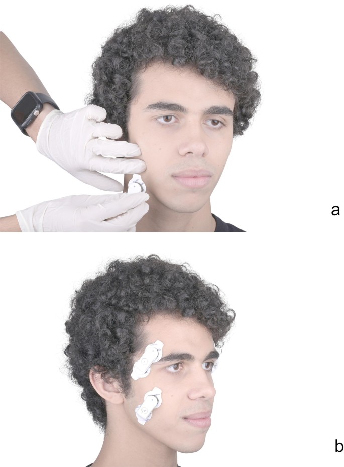 Anterior temporalis and masseter muscle activity with different centric ...