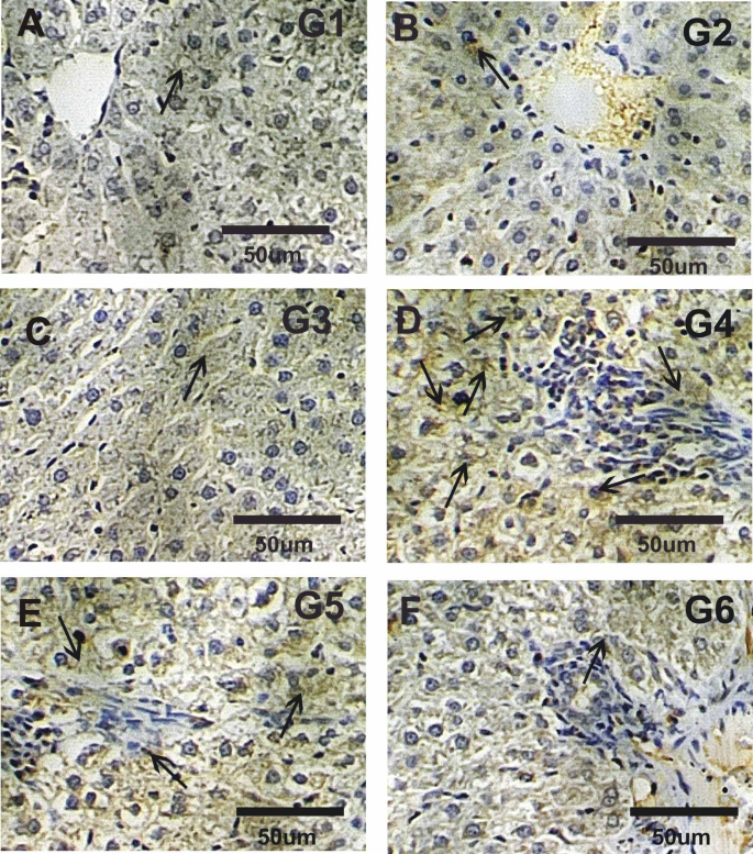 Ferrite chitosan curcumin nanoparticles alleviate nandrolone decanote ...
