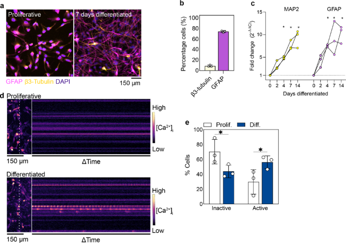 Remodeling of calcium signaling and store operated calcium entry as a ...
