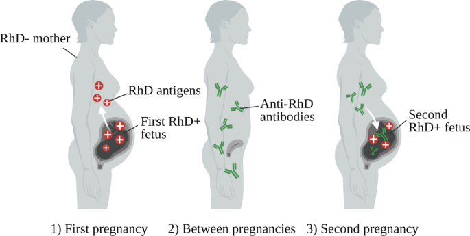 Novel proof of concept assay for rapid, simplified non-invasive fetal ...