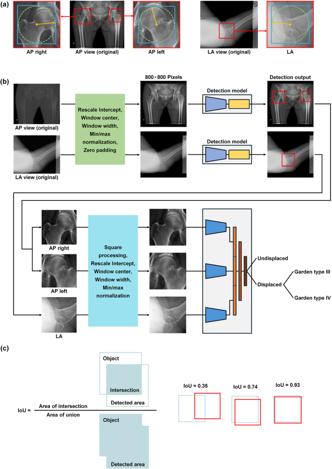 Garden classification of femoral neck fracture using deep-learning ...