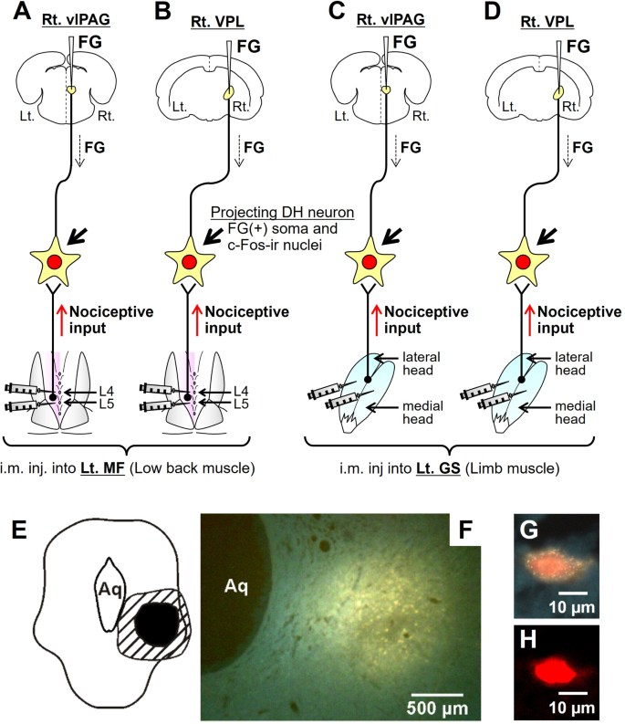 Central projections of nociceptive input originating from the low back ...