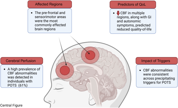 Novel brain SPECT imaging unravels abnormal cerebral perfusion in ...