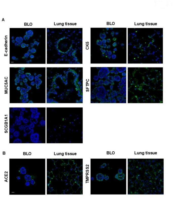 Establishment of a bat lung organoid culture model for studying bat ...