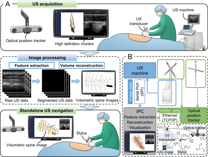 Standalone ultrasound-based highly visualized volumetric spine imaging ...