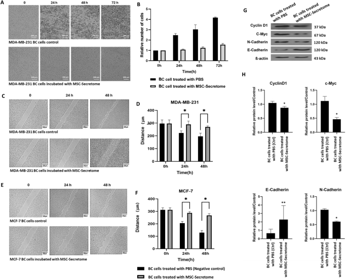 Mesenchymal stem cells modulate breast cancer progression through their ...