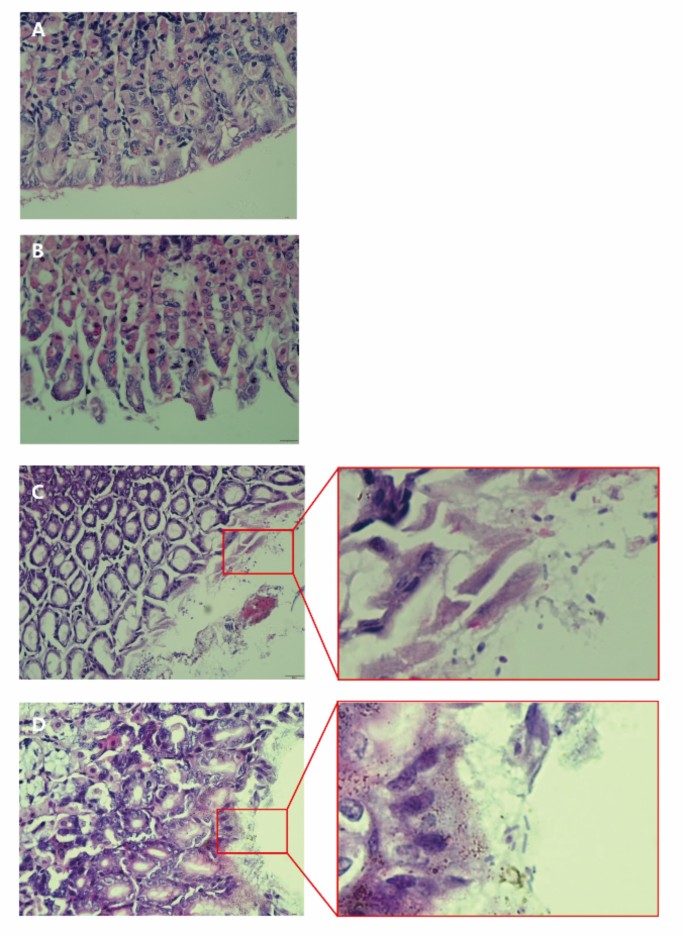 Portal hypertension aggravates Helicobacter pylori induced liver injury ...