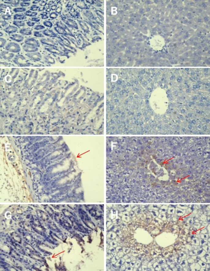 Portal hypertension aggravates Helicobacter pylori induced liver injury ...