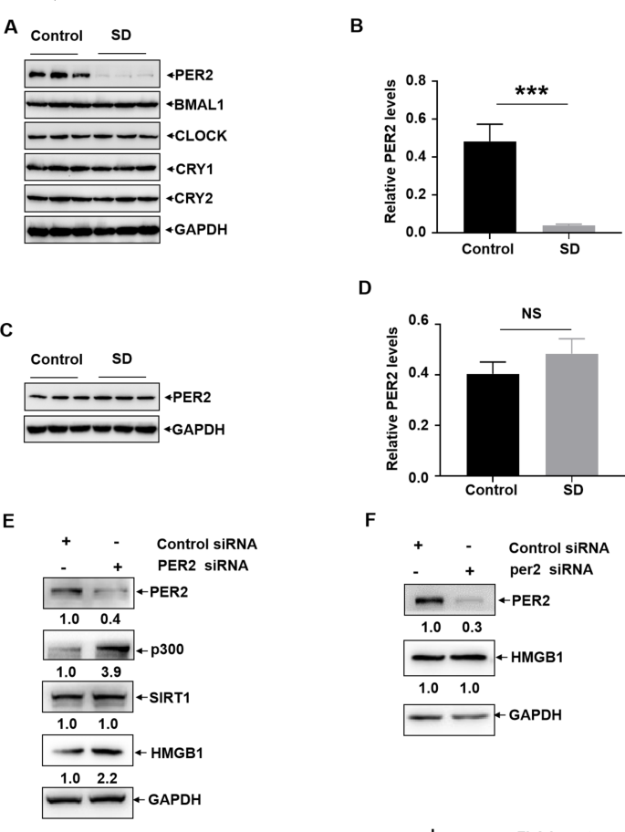 Involvement of circadian clock protein PER2 in controlling sleep ...