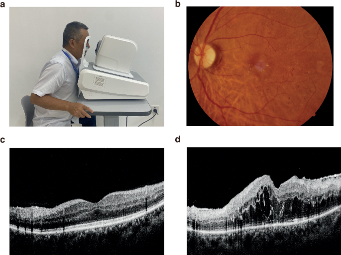 Cost-effectiveness of incorporating self-imaging optical coherence ...