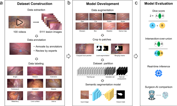 Artificial intelligence assisted real-time recognition of intra ...