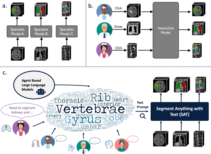 Large-vocabulary segmentation for medical images with text prompts ...
