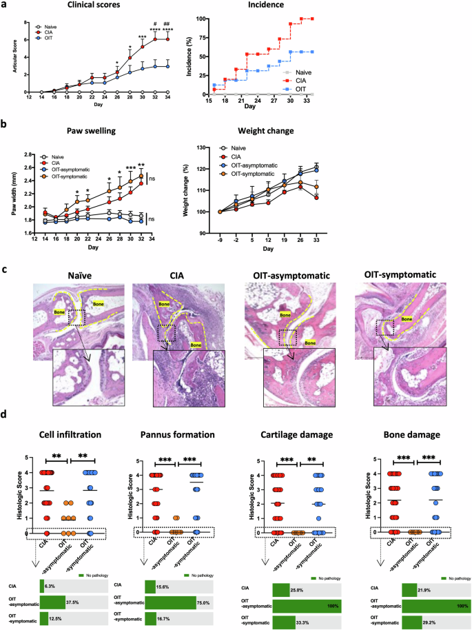 Undenatured type II collagen protects against collagen-induced ...