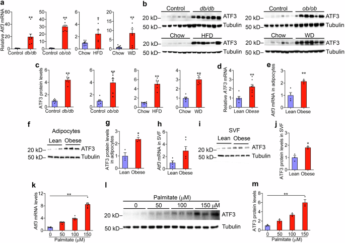 Loss of adipose ATF3 promotes adipose tissue lipolysis and the ...